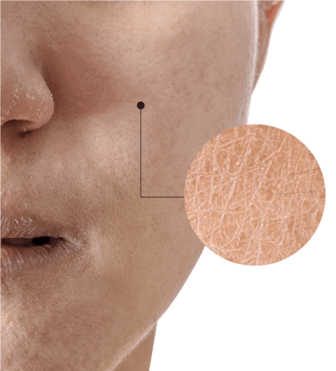 Dr Dermis | SKIN TYPES