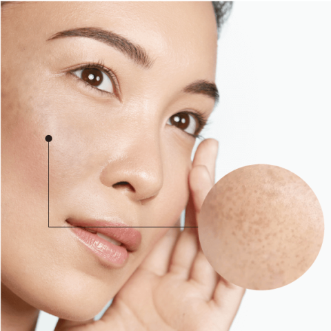 Dr Dermis | SKIN TYPES